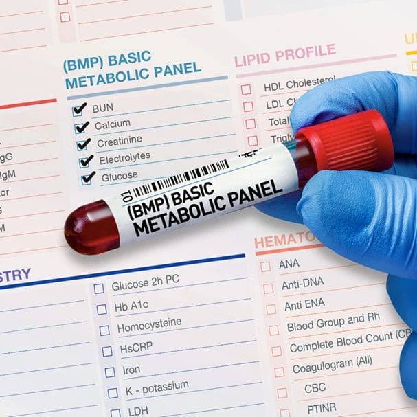 Everything You Need to Know About Laboratory Tests for Better Health ...